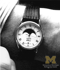 Distorted Vision (Metamorphopsia) : Eye Symptoms & Signs : The Eyes Have It